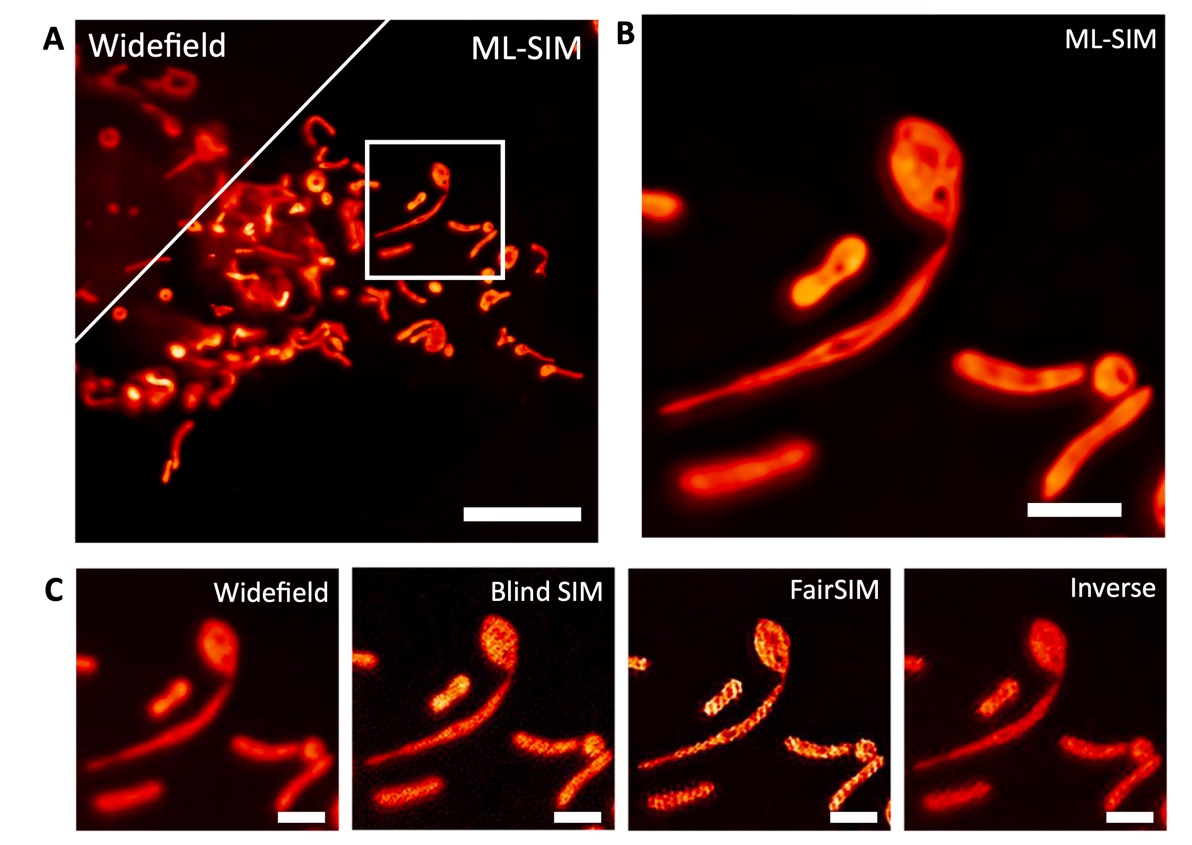 MAI-SIM: interferometric multicolor structured illumination microscopy for everybody | Charles ...